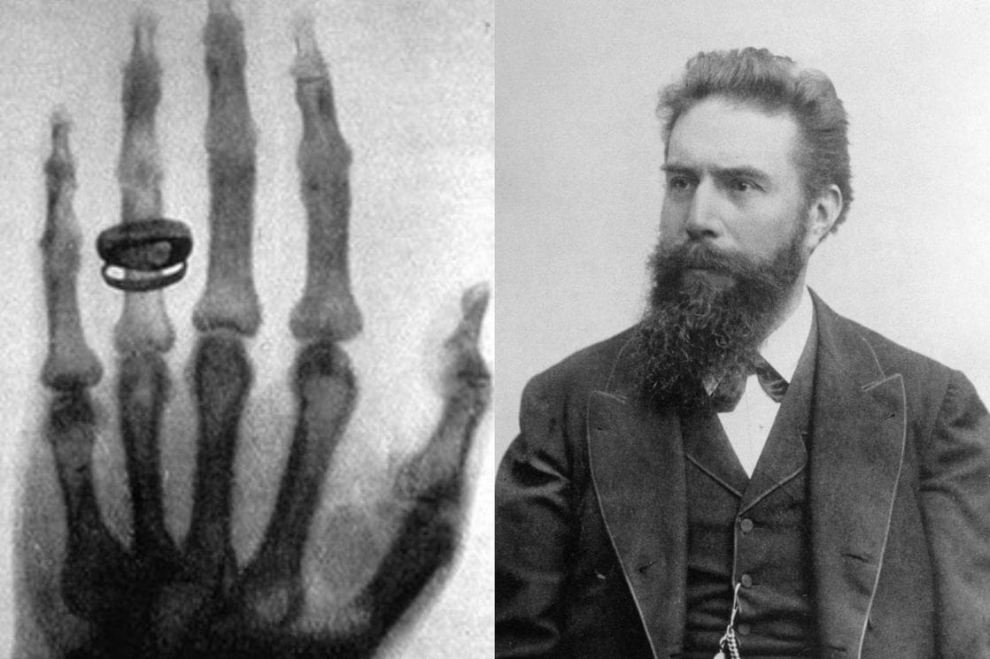 Na današnji dan: Rendgen otkrio X-zrake