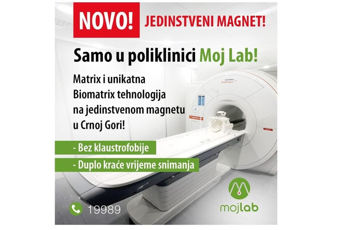 Samo u poliklinici Moj Lab: Matrix i BioMatrix tehnologija na ...